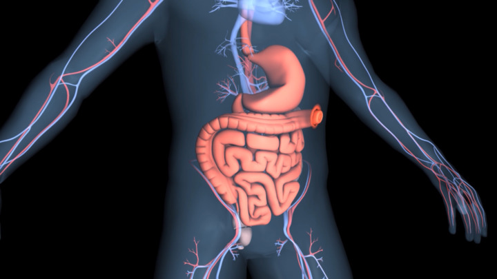 Video - What is a Colostomy? - HealthClips Online