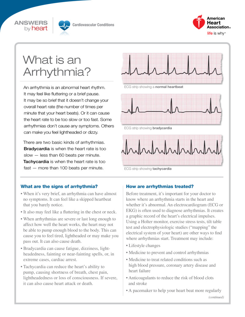 PDF - What is an Arrhythmia? - HealthClips Online