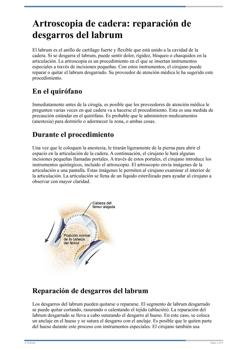 Text - Artroscopia de cadera: reparación de desgarros del labrum ...