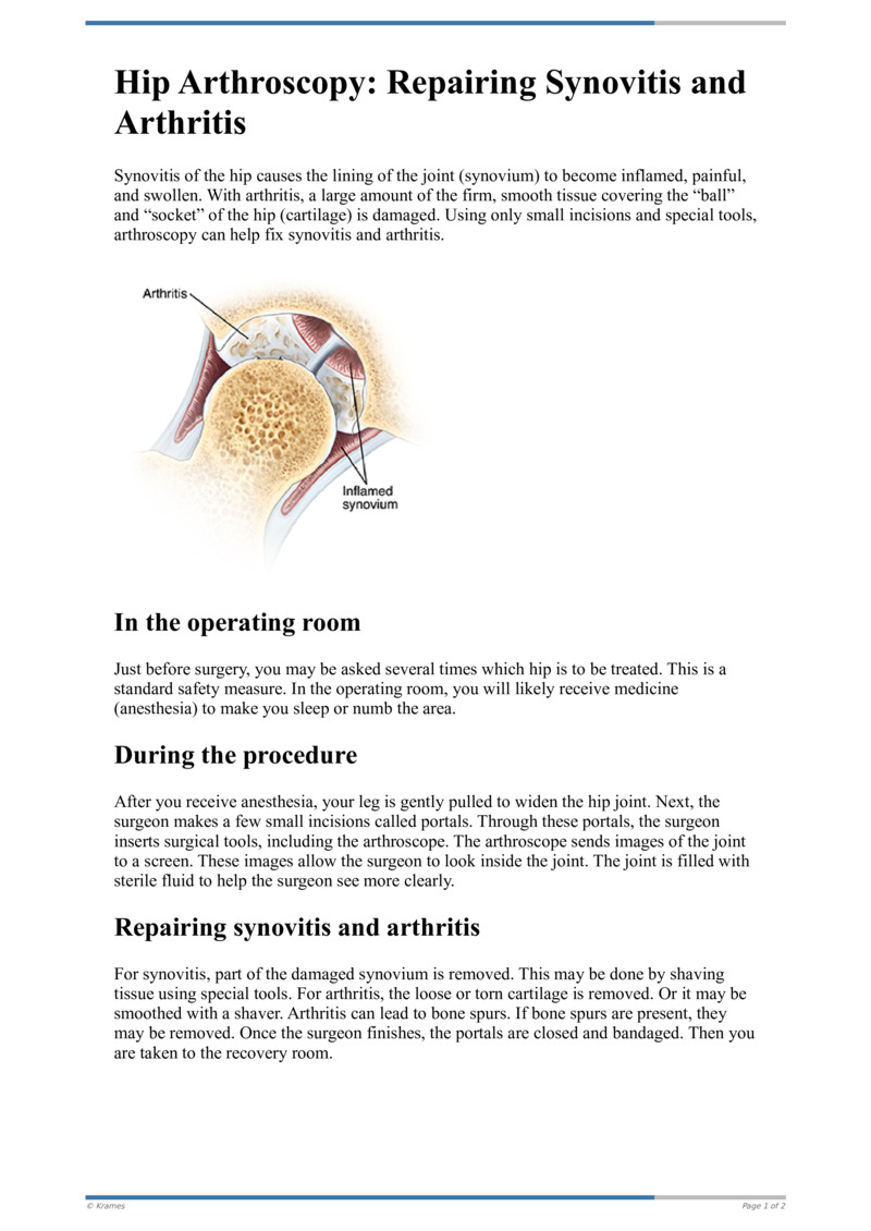 Text - Hip Arthroscopy: Repairing Synovitis and Arthritis - HealthClips ...