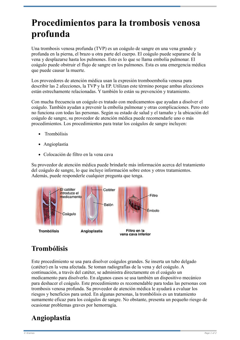 Text - Procedimientos para la trombosis venosa profunda - HealthClips ...
