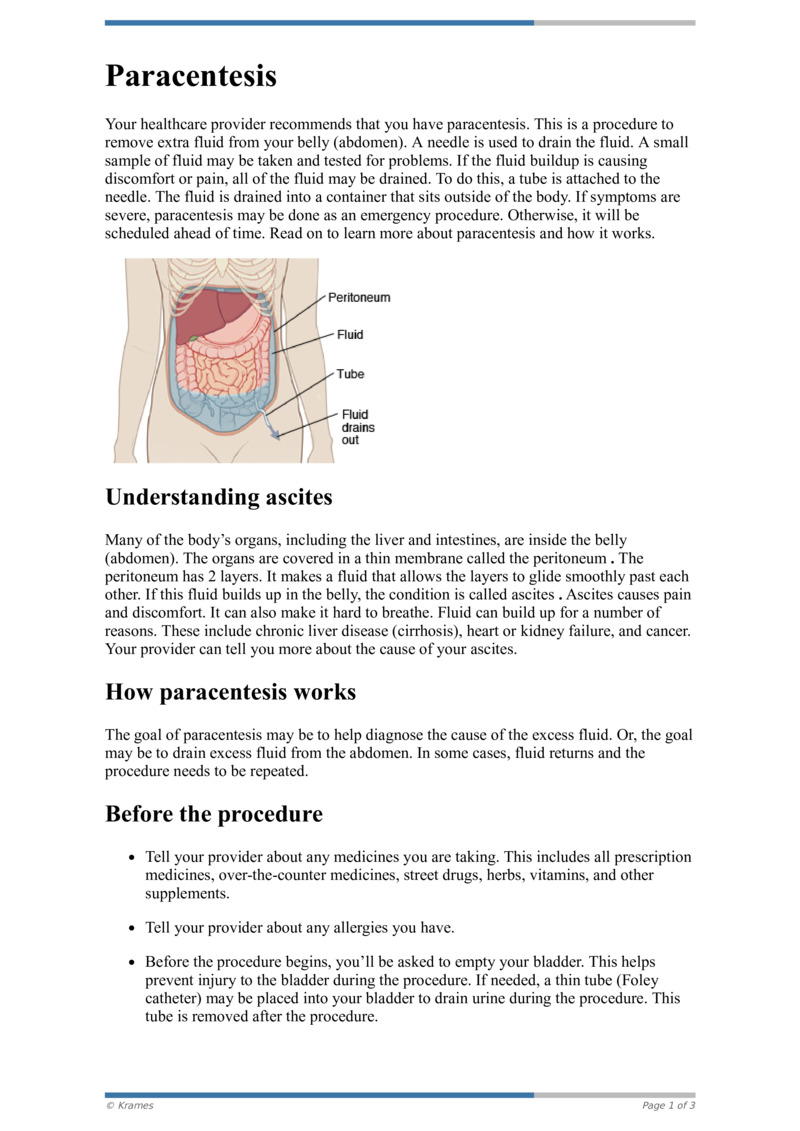 Text - Paracentesis - HealthClips Online
