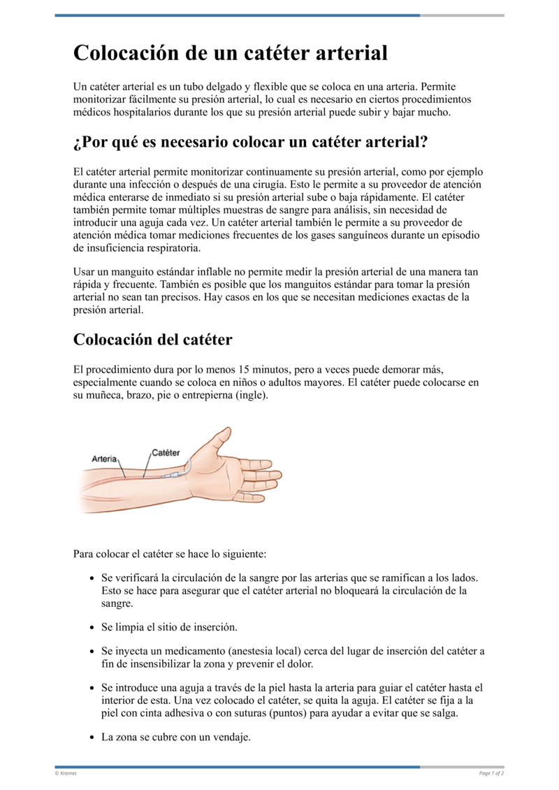 Text - Colocación de un catéter arterial - HealthClips Online