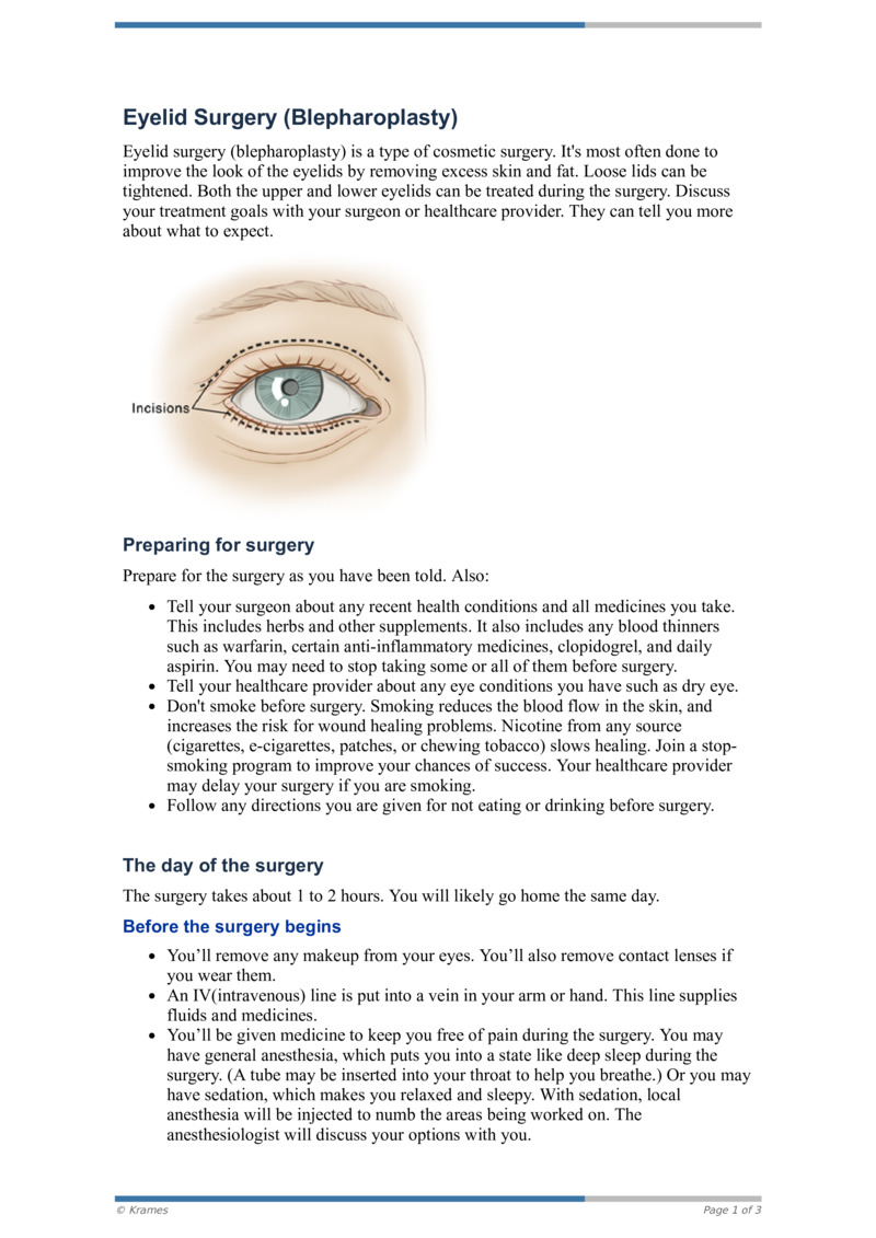 PDF - Eyelid Surgery (Blepharoplasty) - HealthClips Online