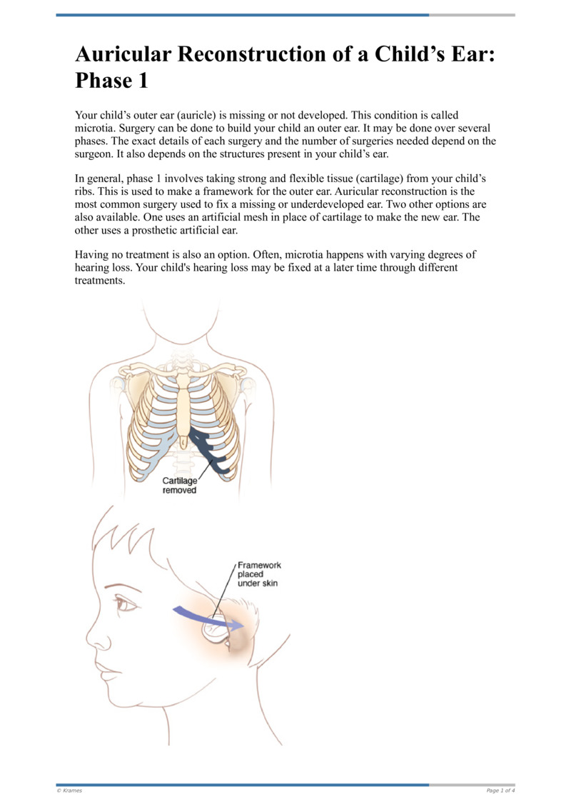 Text - Auricular Reconstruction of a Child's Ear: Phase 1 - HealthClips ...