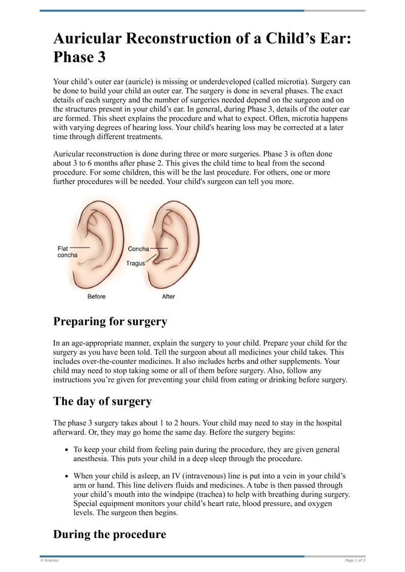 PDF - Auricular Reconstruction of a Child's Ear: Phase 3 - HealthClips ...