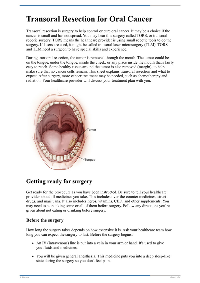 Text - Transoral Resection for Oral Cancer - HealthClips Online