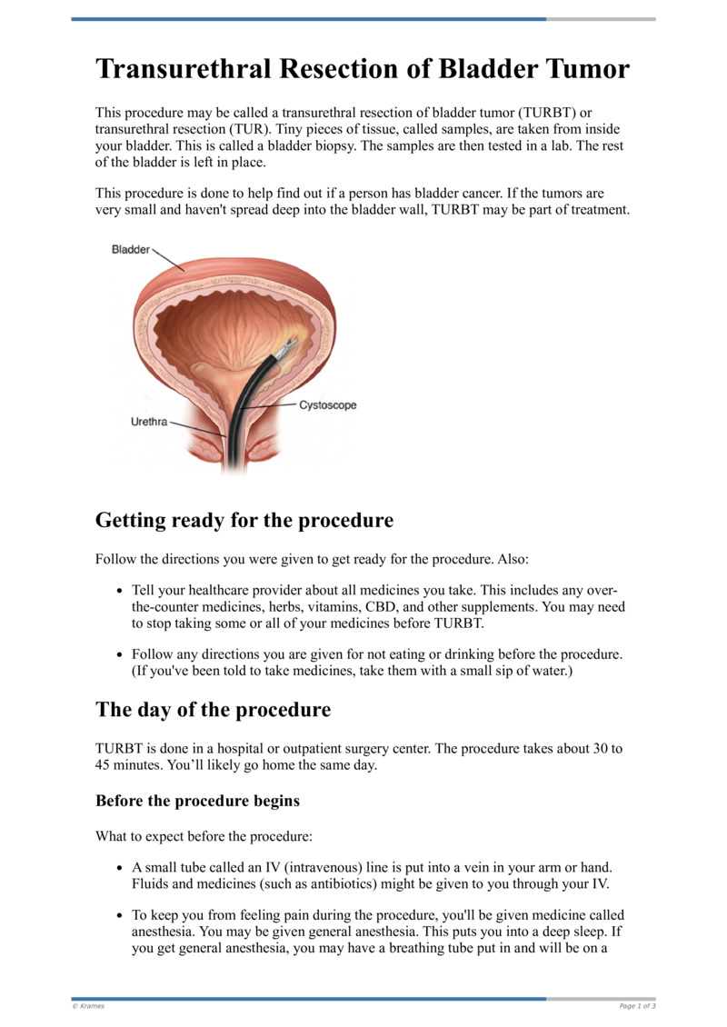 Text Transurethral Resection Of Bladder Tumor HealthClips Online