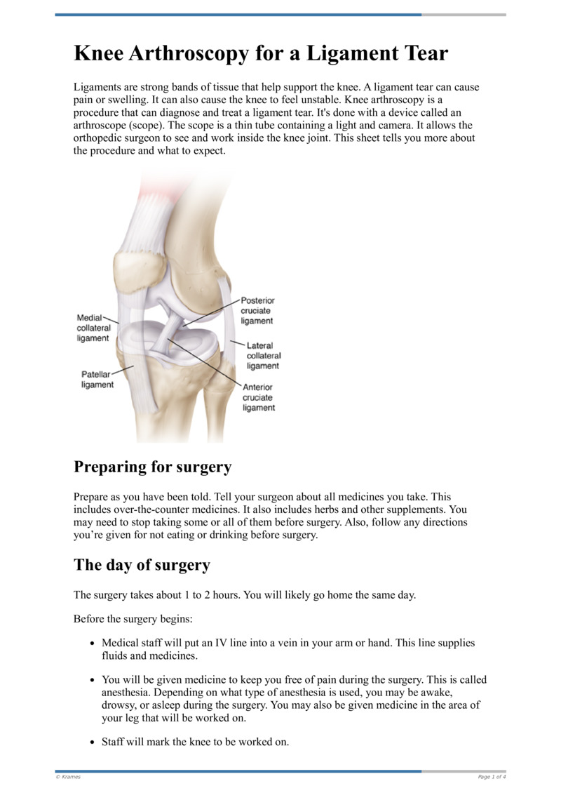 Text - Knee Arthroscopy for a Ligament Tear - HealthClips Online