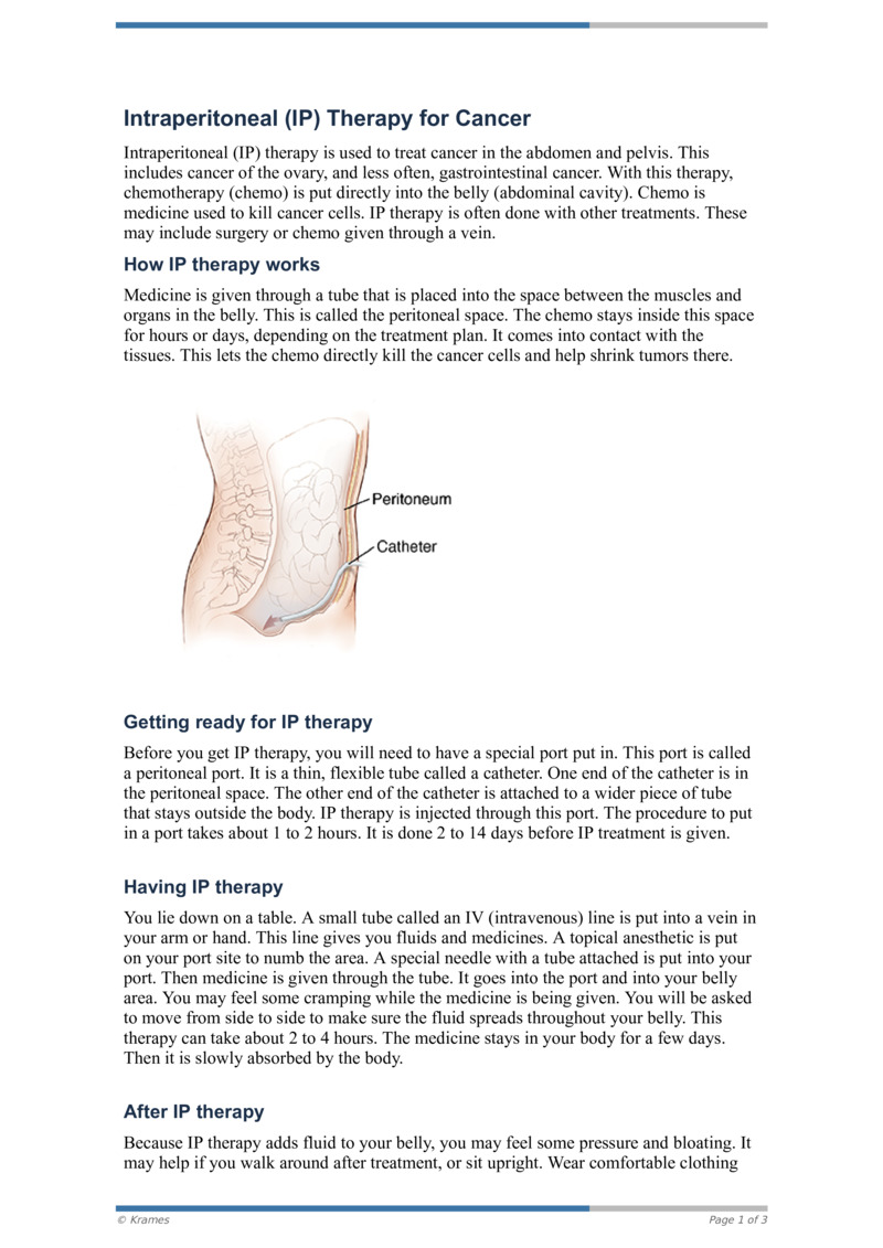 PDF - Intraperitoneal (IP) Therapy for Cancer - HealthClips Online
