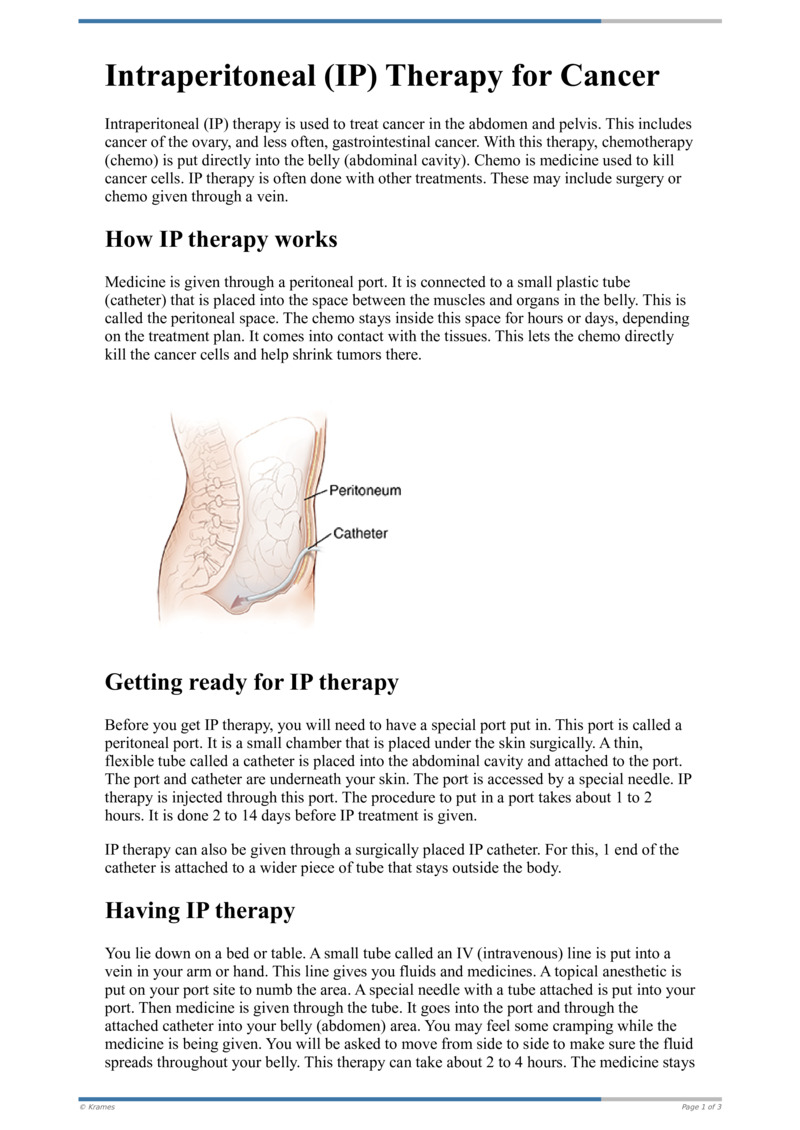 Text - Intraperitoneal (IP) Therapy for Cancer - HealthClips Online