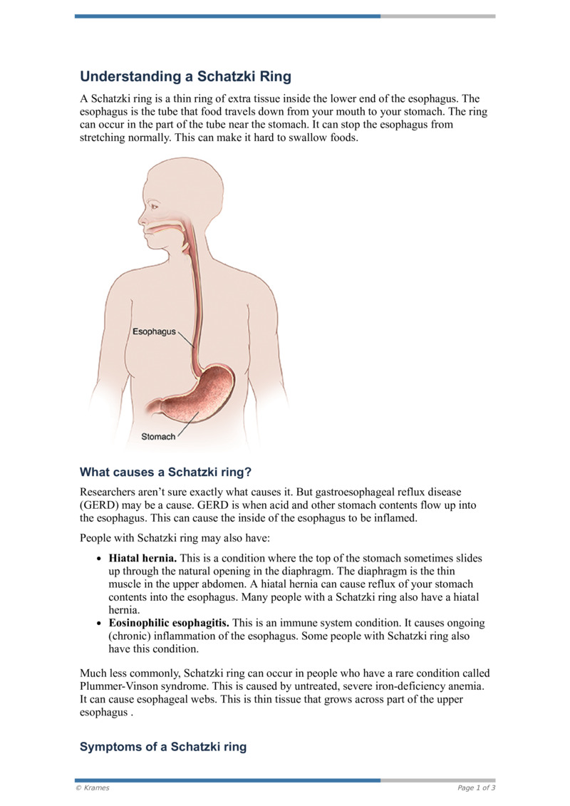 PDF - Understanding a Schatzki Ring - HealthClips Online