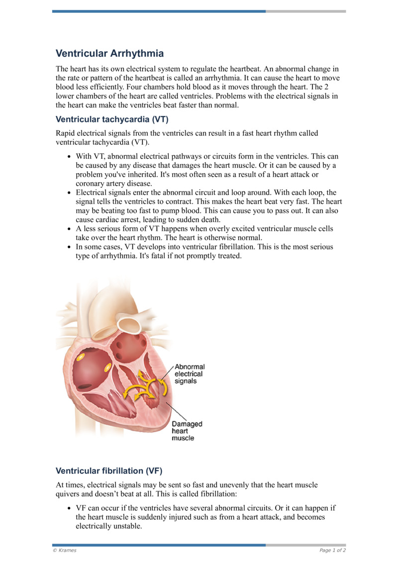 PDF - Ventricular Arrhythmia - HealthClips Online