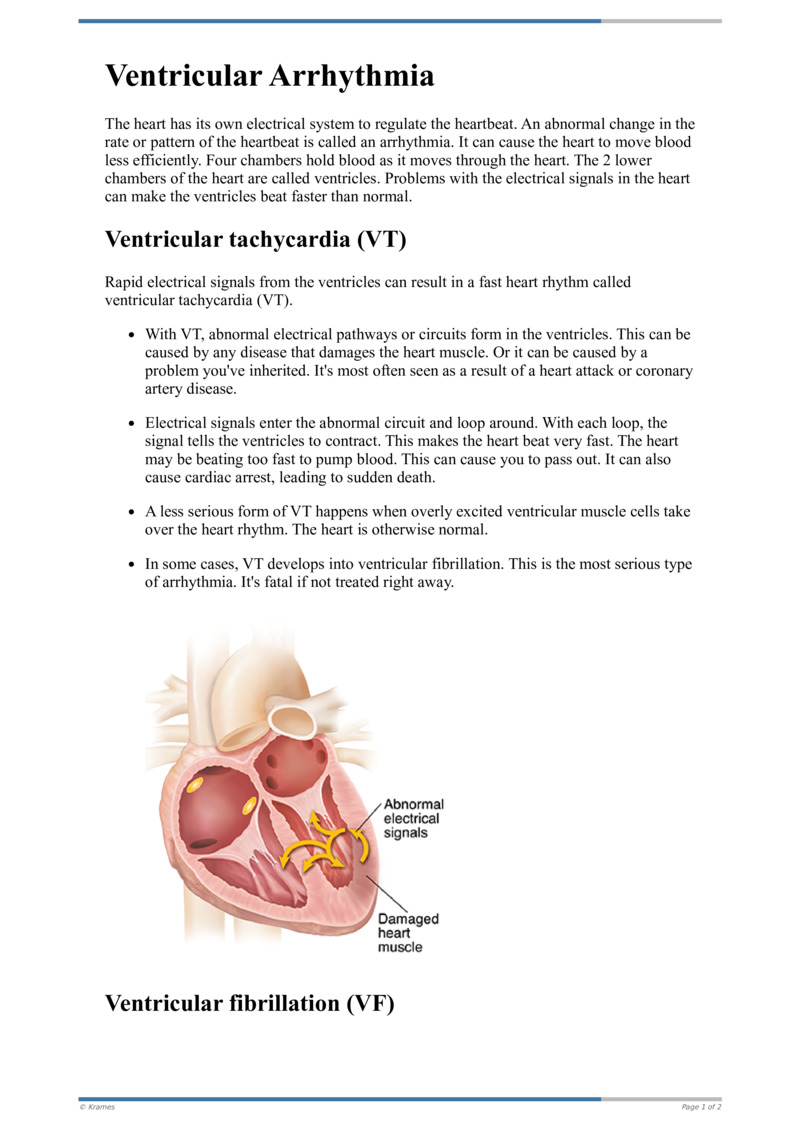 Text - Ventricular Arrhythmia - HealthClips Online