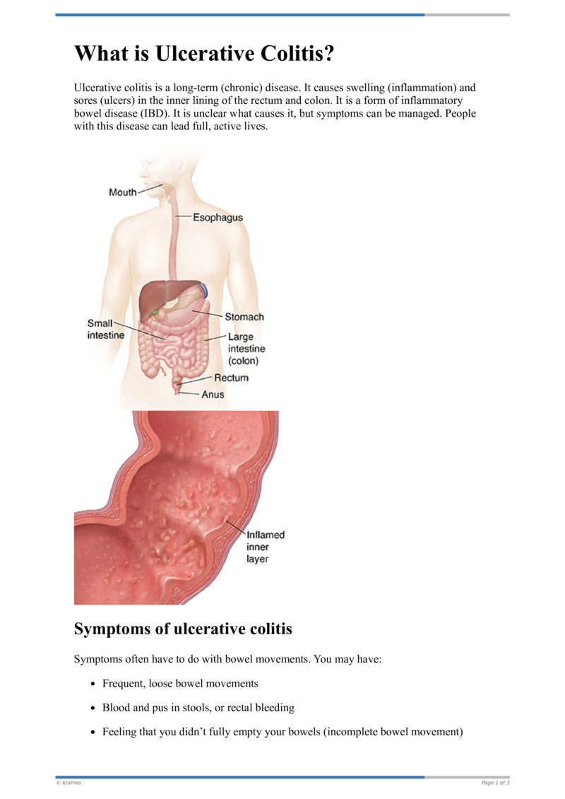 Text - What Is Ulcerative Colitis? - HealthClips Online