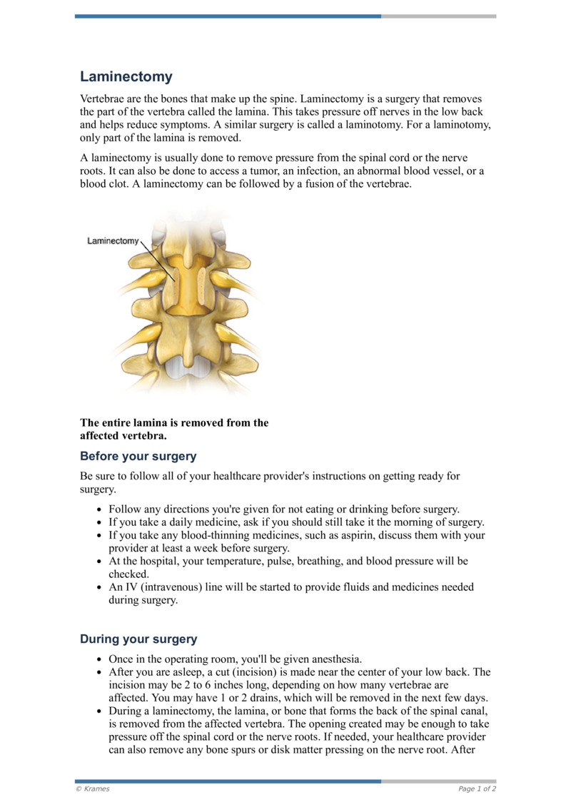 PDF - Laminectomy - HealthClips Online