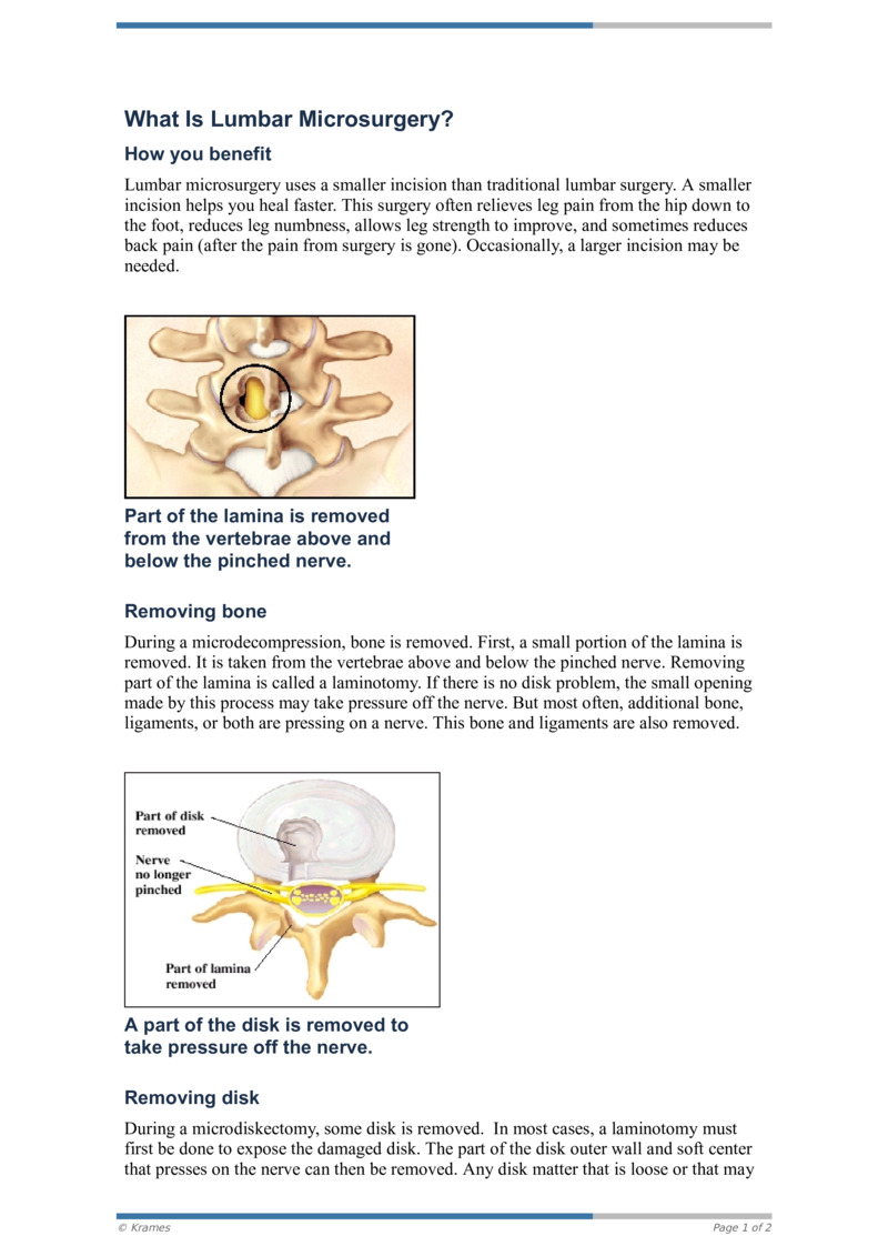 PDF - What Is Lumbar Microsurgery? - HealthClips Online