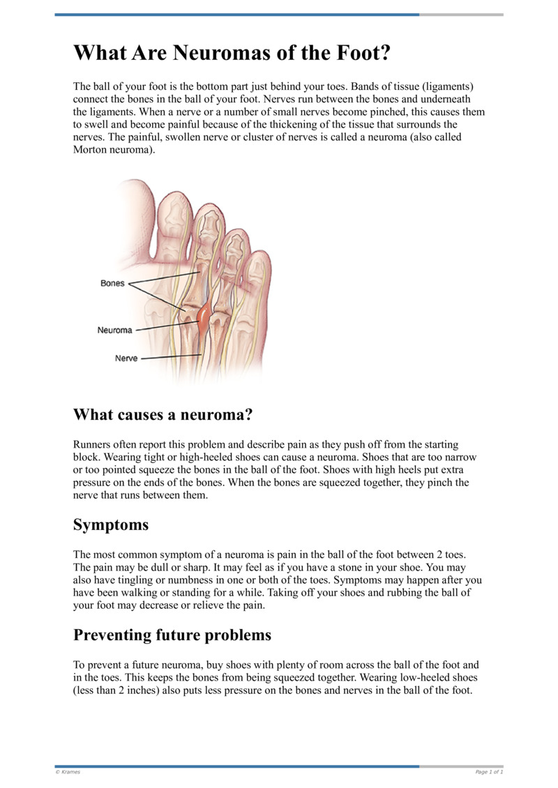 Text - What Are Neuromas of the Foot? - HealthClips Online