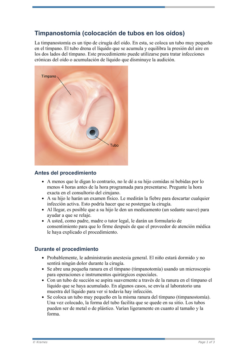 PDF - Timpanostomía (colocación de tubos en los oídos) - HealthClips Online