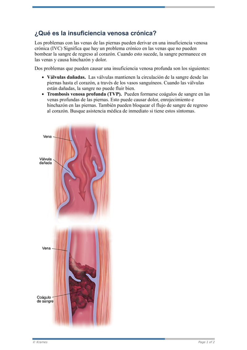 PDF - ¿Qué es la insuficiencia venosa crónica? - HealthClips Online