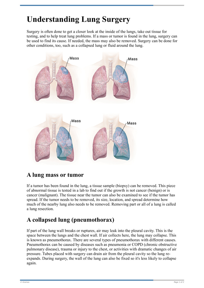 Text - Understanding Lung Surgery - HealthClips Online