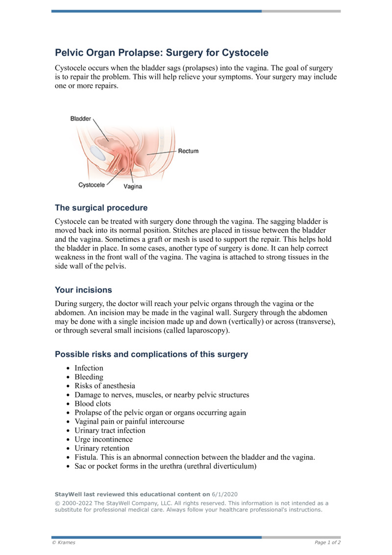 PDF - Pelvic Organ Prolapse: Surgery for Cystocele - HealthClips Online