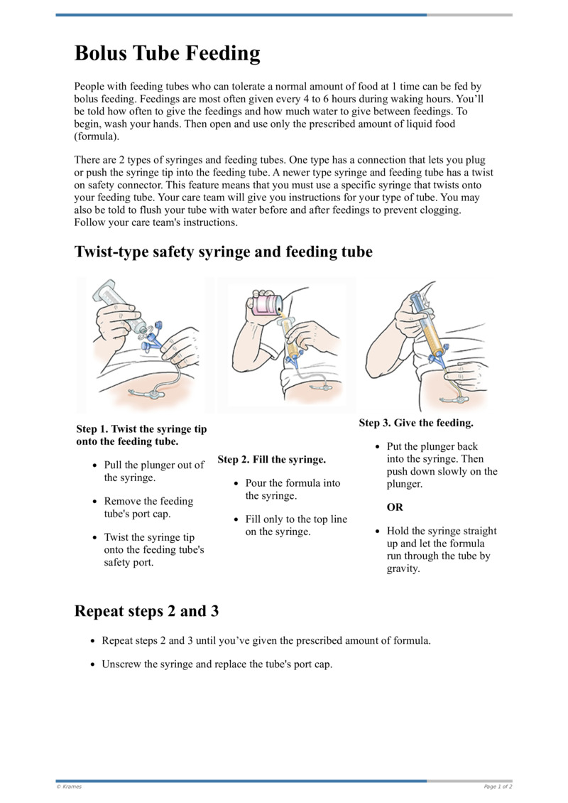 How To Calculate Bolus Tube Feed Rate Cheat Sheet Vro - vrogue.co How To Calculate Bolus Tube Feed Rate Cheat Sheet Vro - vrogue.co