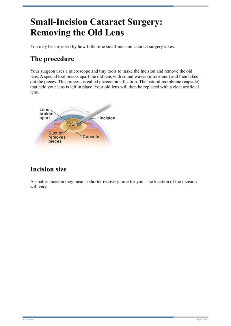 Text - Small-Incision Cataract Surgery: Removing the Old Lens ...