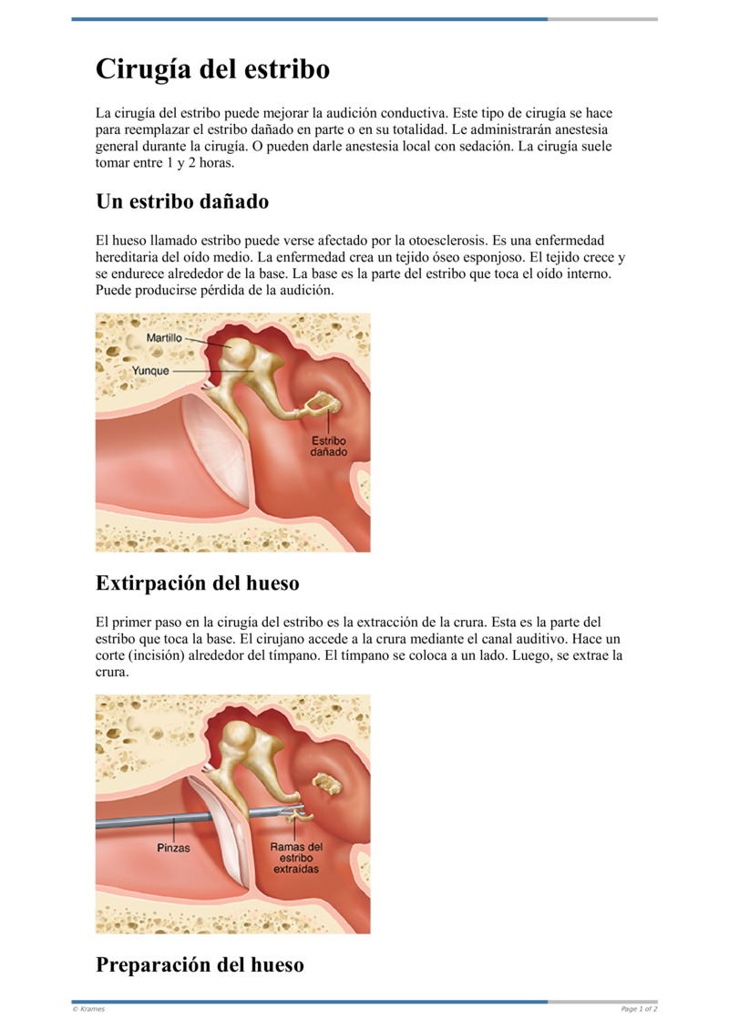 Text - Cirugía del estribo - HealthClips Online