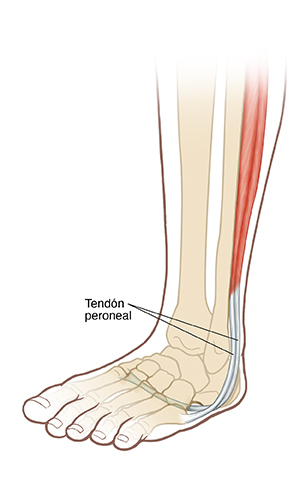 Texto - ¿Qué es la tendinitis del pie? - HealthClips Online