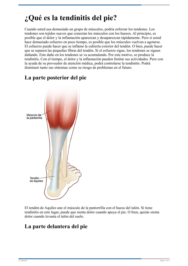 Text - ¿Qué es la tendinitis del pie? - HealthClips Online