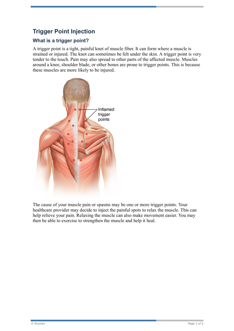 PDF - Trigger Point Injection - HealthClips Online