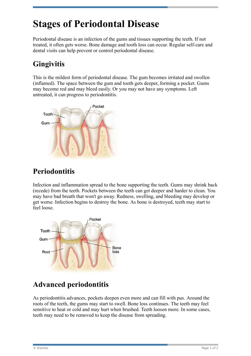 PDF - Stages of Periodontal Disease - HealthClips Online