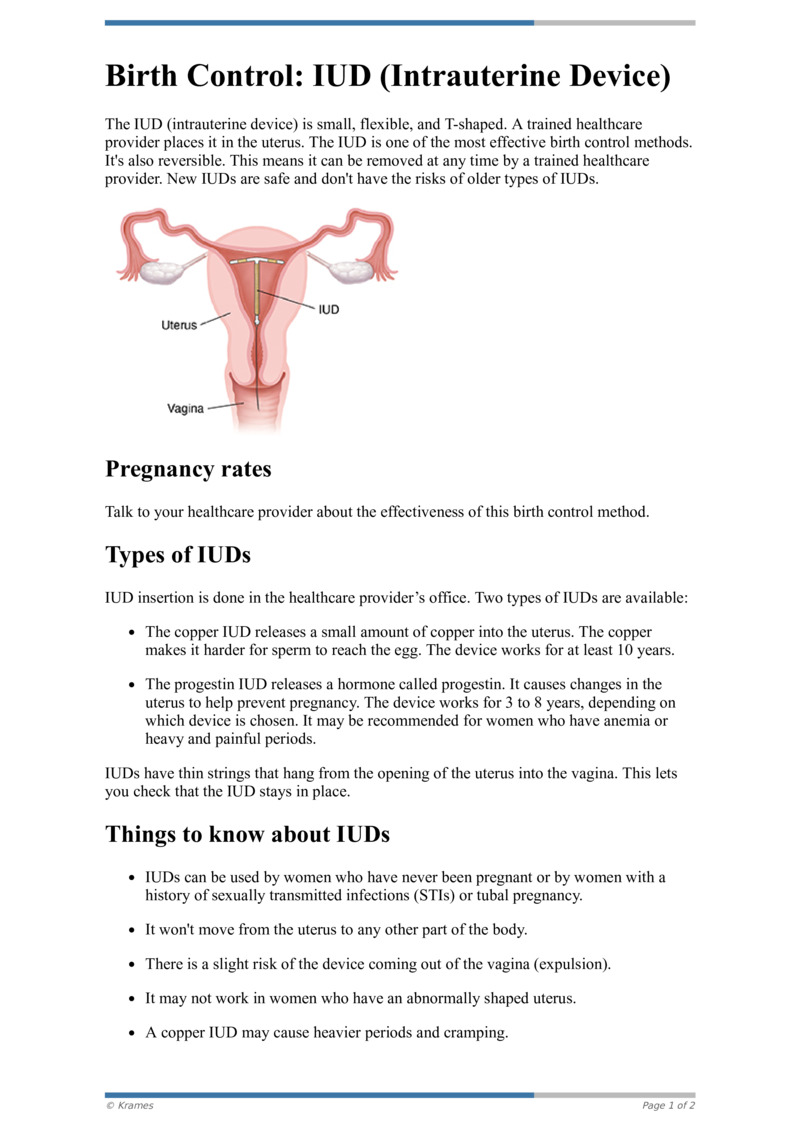 Text - Birth Control: IUD (Intrauterine Device) - HealthClips Online