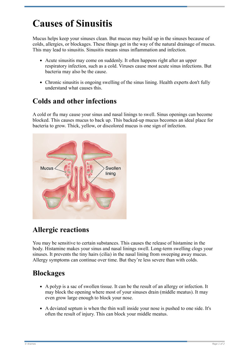 Text - Causes of Sinusitis - HealthClips Online