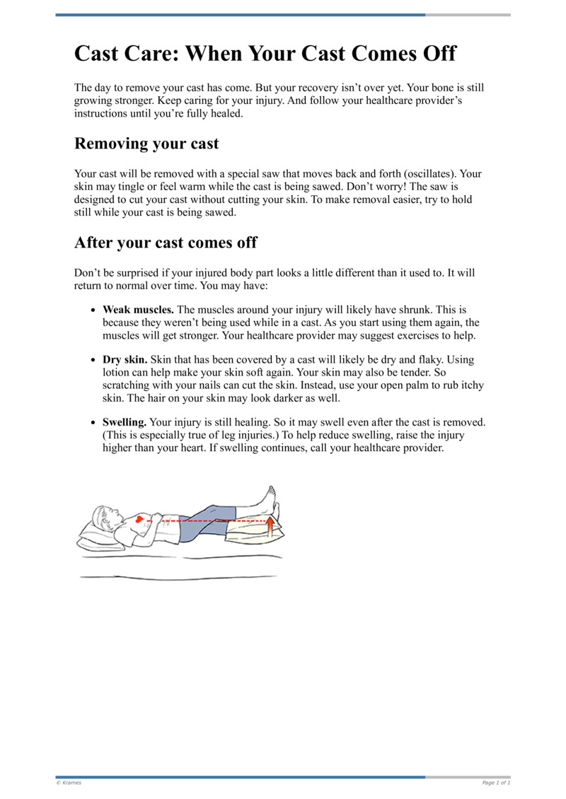 Text - Cast Care: When Your Cast Comes Off - HealthClips Online