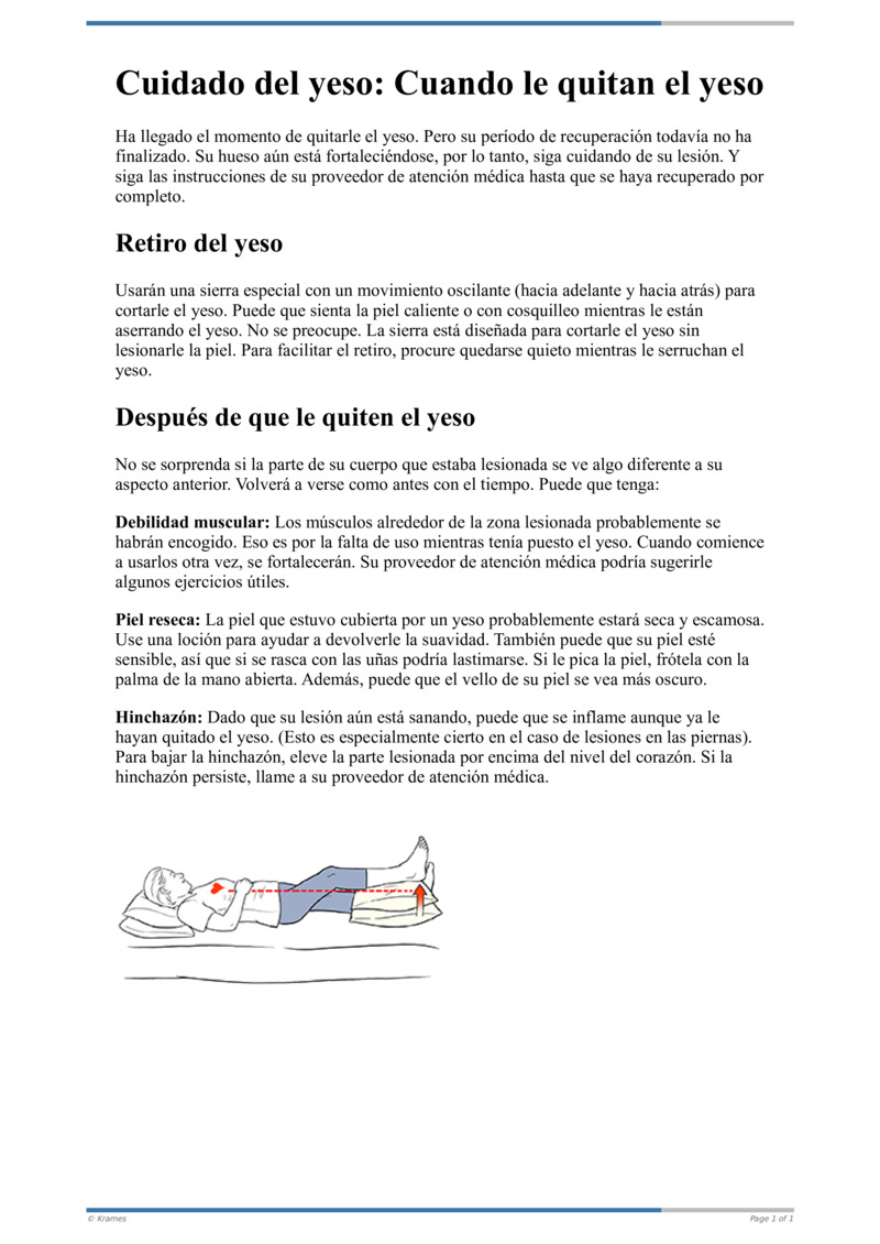 Text - Cuidado del yeso: Cuando le quitan el yeso - HealthClips Online