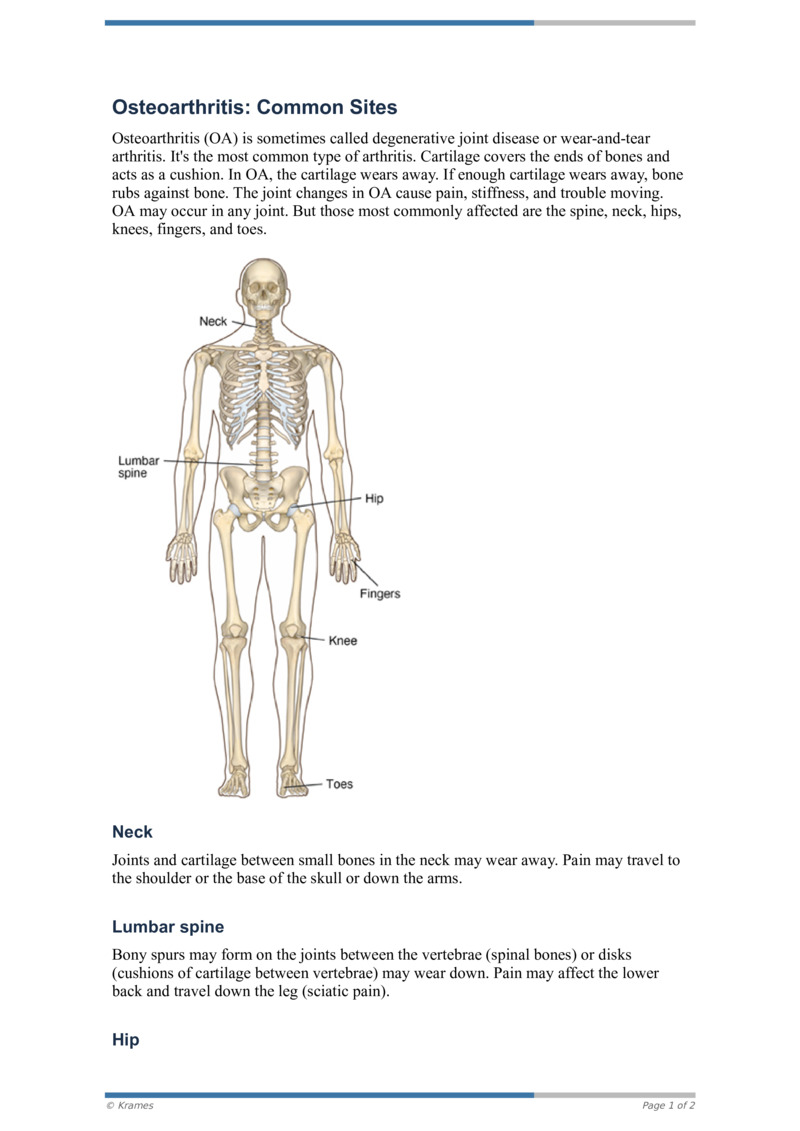 PDF - Osteoarthritis: Common Sites - HealthClips Online