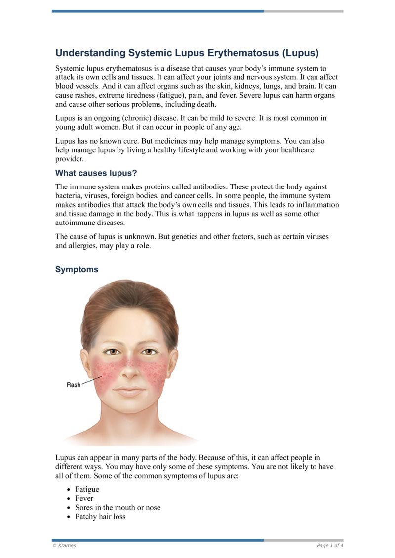 PDF - Understanding Systemic Lupus Erythematosus (Lupus) - HealthClips ...