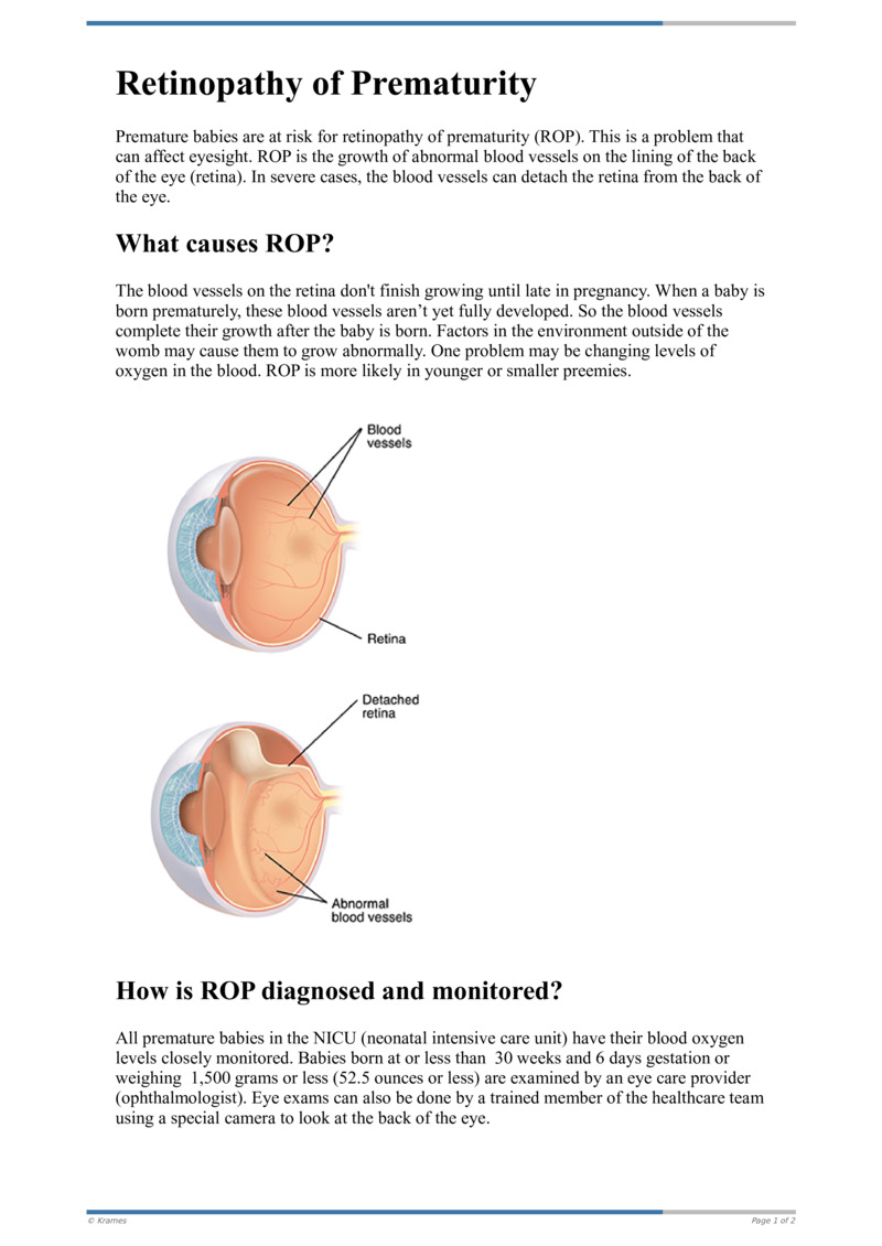 Text - Retinopathy of Prematurity (ROP) - HealthClips Online