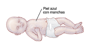 Text - Cambios del color de la piel del recién nacido - HealthClips Online