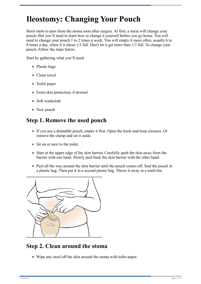 Text - Ileostomy: Changing Your Pouch - HealthClips Online