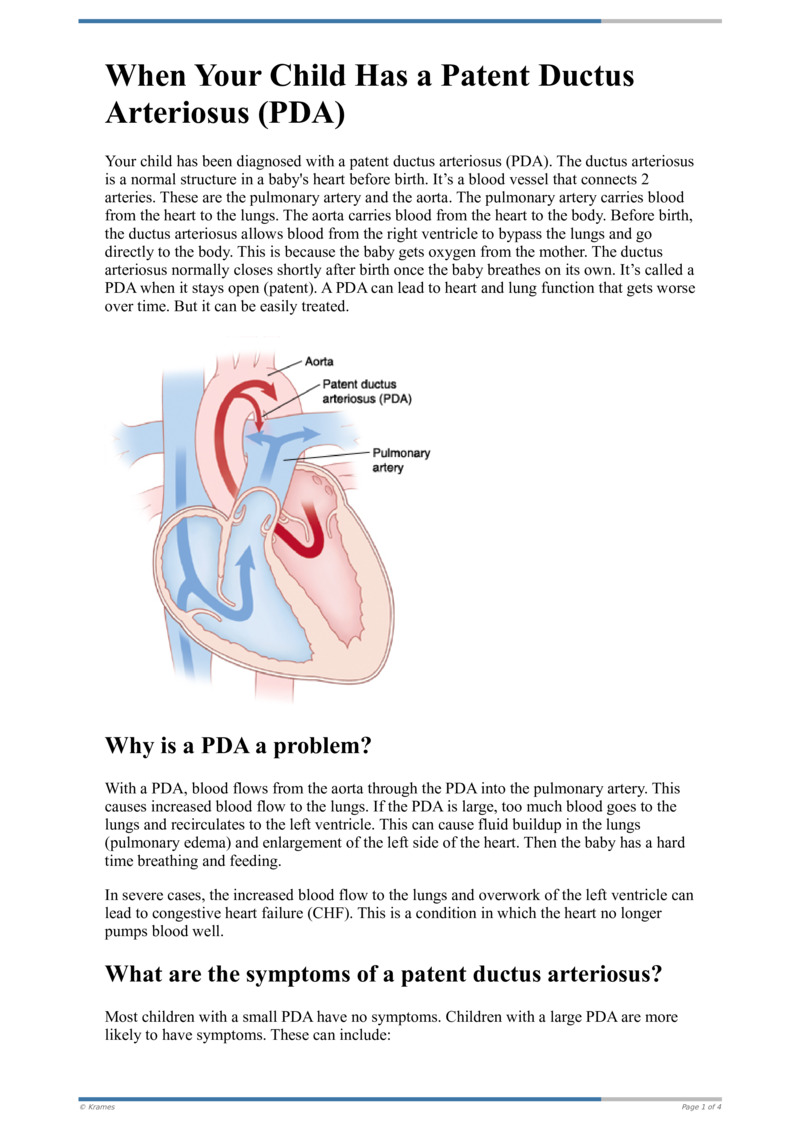 Text - When Your Child Has a Patent Ductus Arteriosus (PDA ...