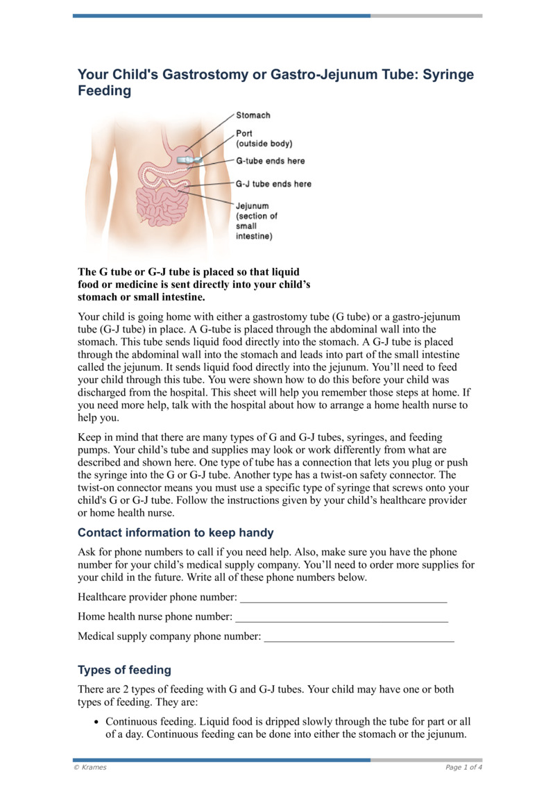 PDF - Your Child's Gastrostomy or Gastro-Jejunum Tube- Syringe Feeding ...