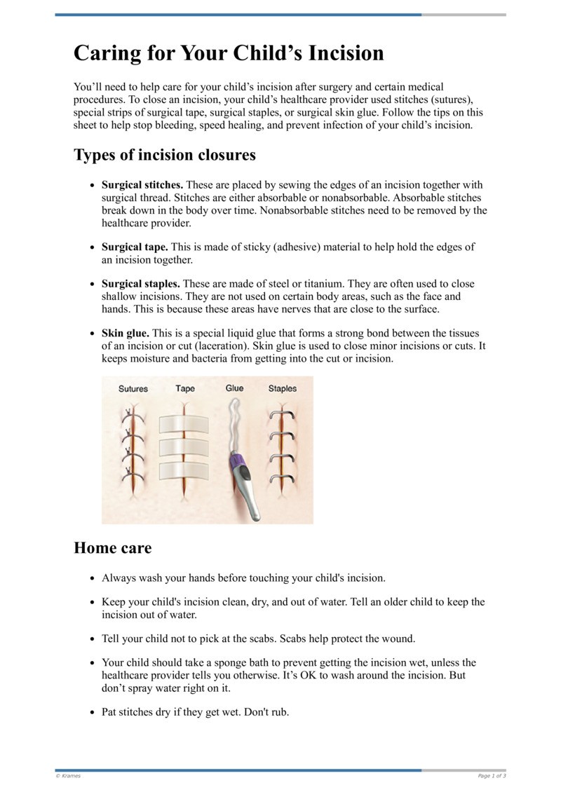 Text - Caring for Your Child's Incision - HealthClips Online