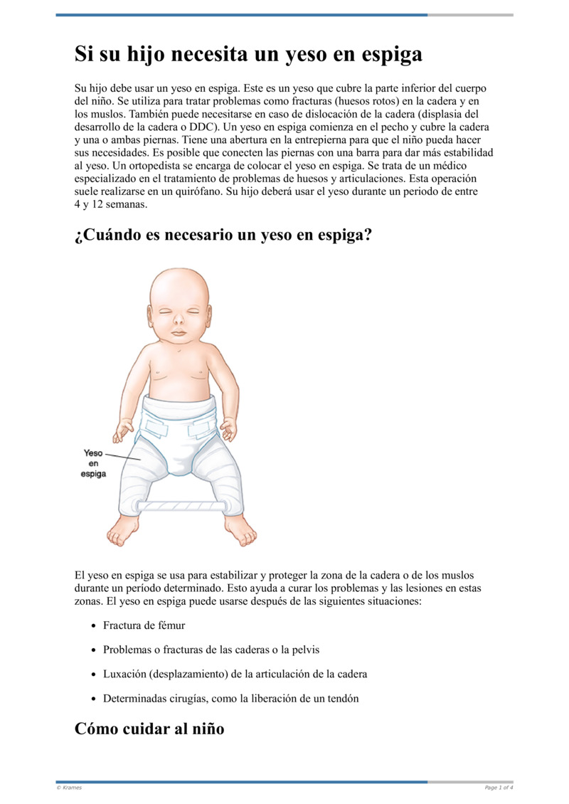 Text - Si su hijo necesita un yeso en espiga - HealthClips Online