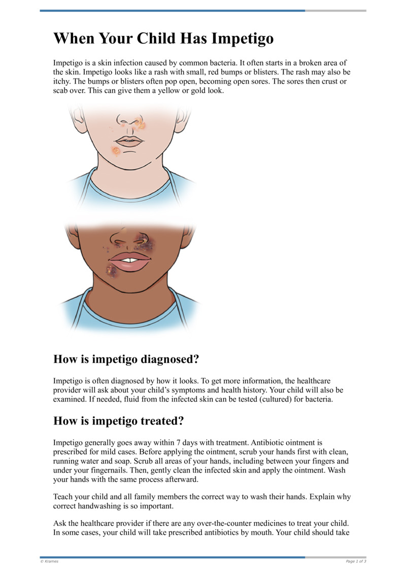 Text - When Your Child Has Impetigo - HealthClips Online
