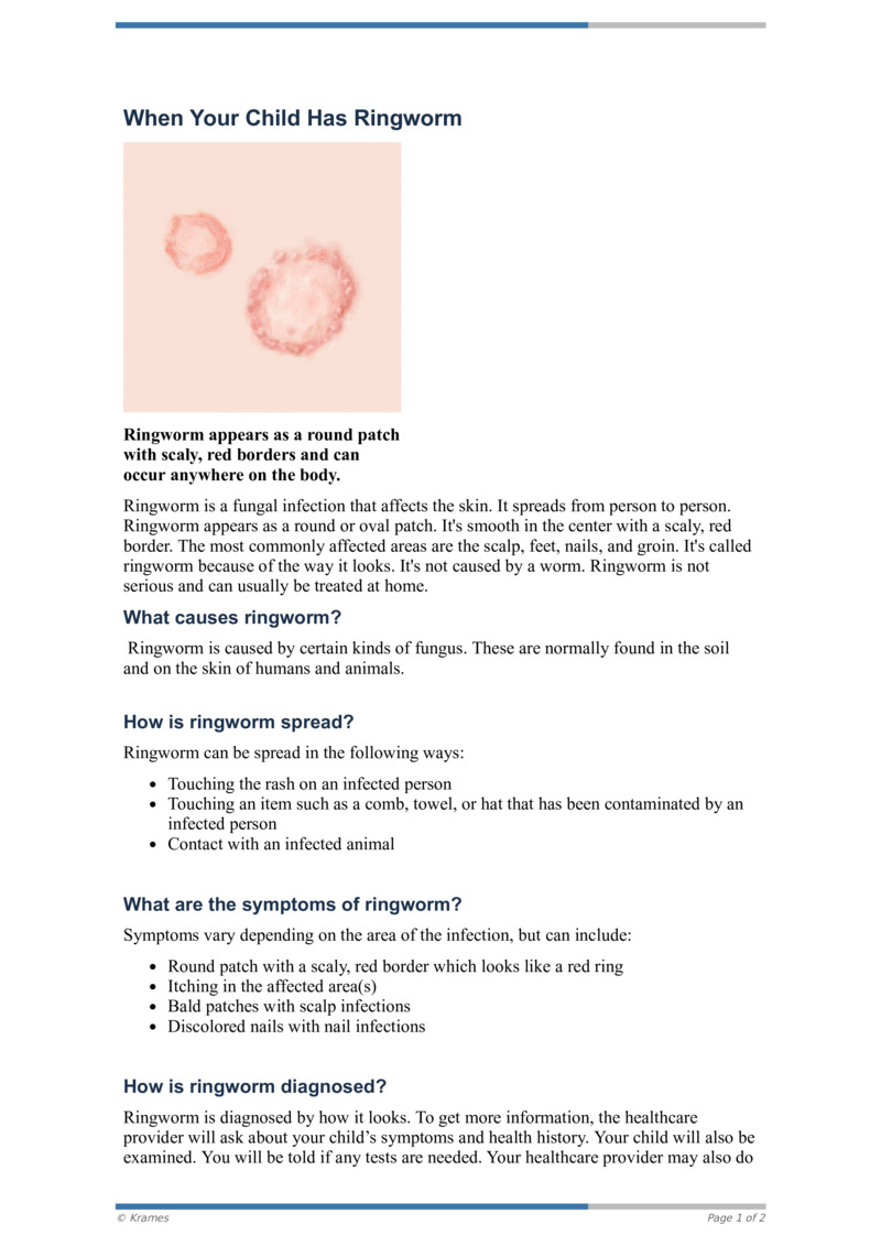 PDF - When Your Child Has Ringworm - HealthClips Online