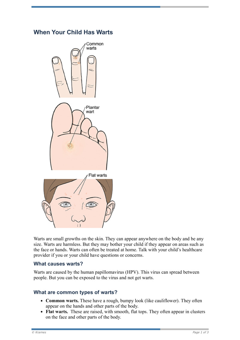 PDF - When Your Child Has Warts - HealthClips Online
