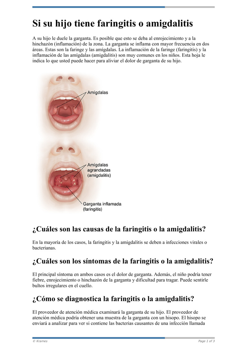 PDF - Si su hijo tiene faringitis o amigdalitis - HealthClips Online